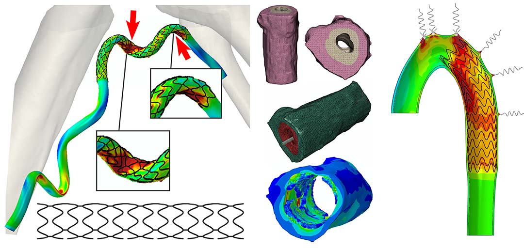 Cardiovascular Biomechanics Research Projects | Cardiovascular ...