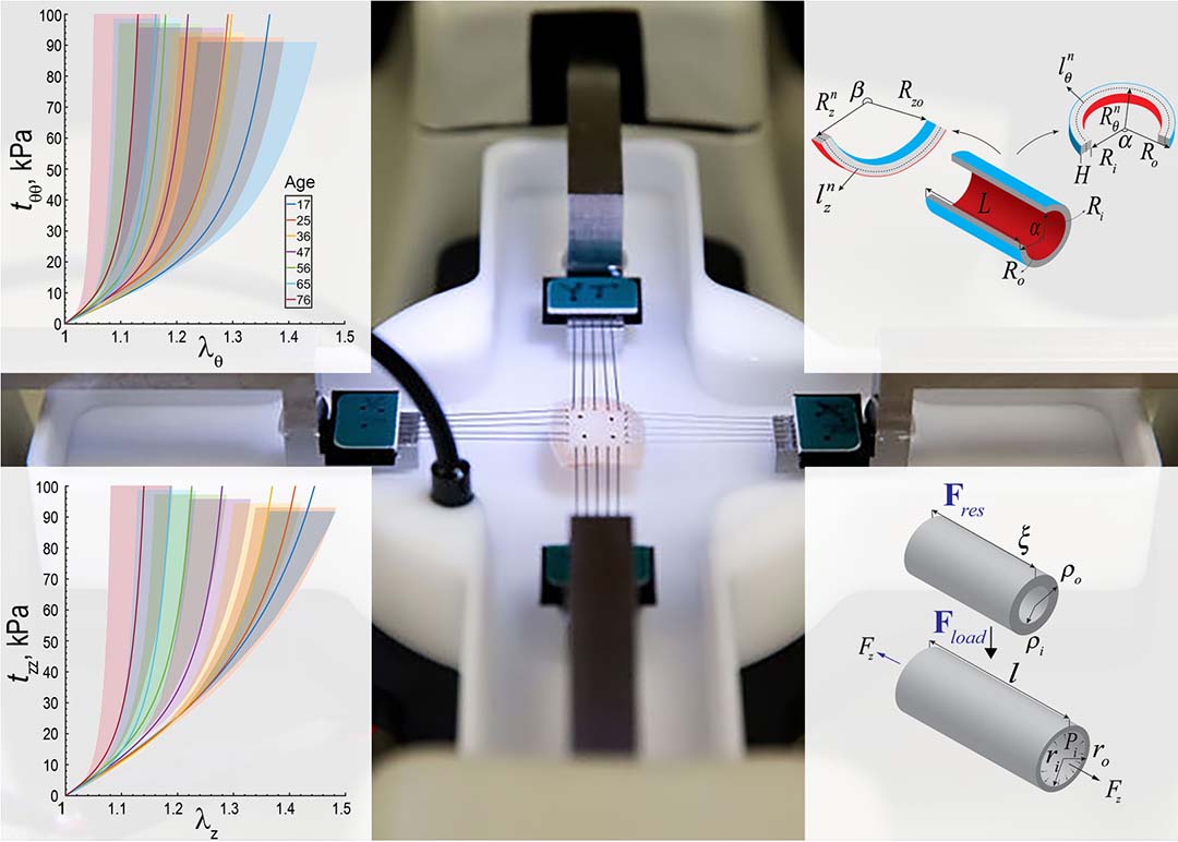 Cardiovascular Biomechanics Research Projects | Cardiovascular ...