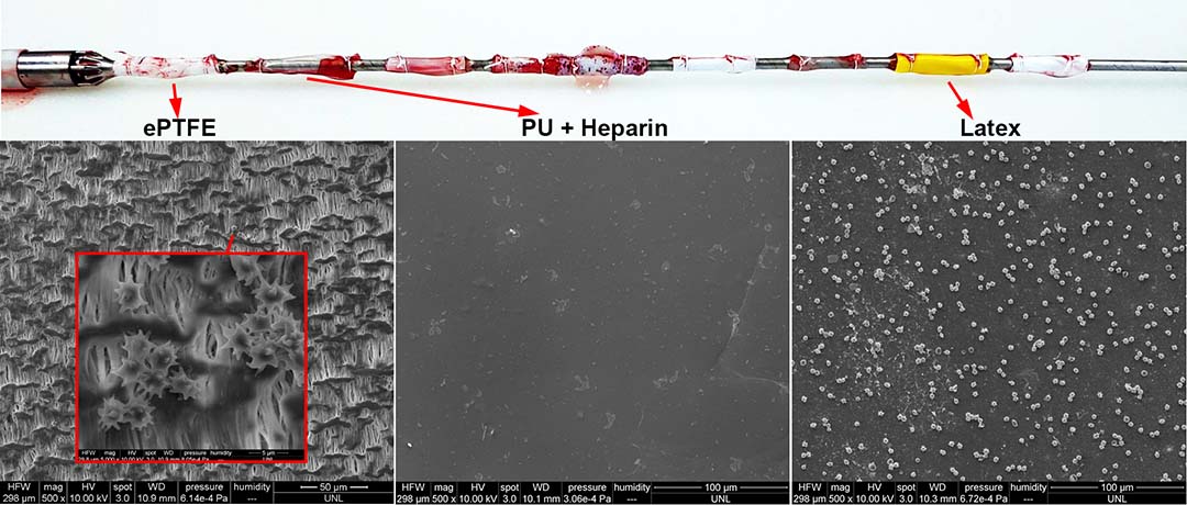 Cardiovascular Biomechanics Research Projects | Cardiovascular ...